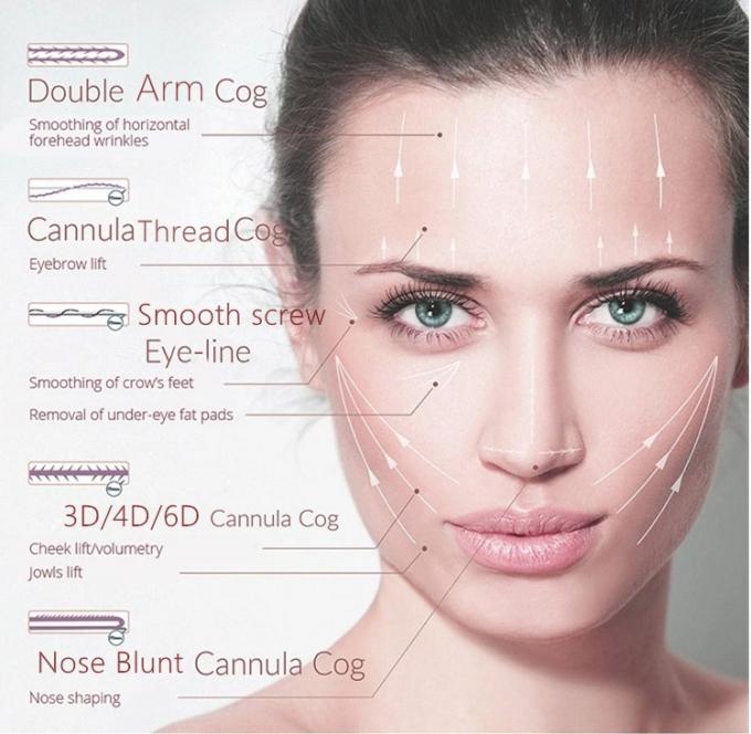 Barbed PDO Barbed Thread Lift For Nose Lift Nasal Thread To Firming Skin