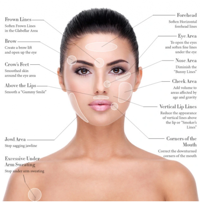 Botulinum Toxin Type A Poison Add 2ml - 2.5ml Normal Saline