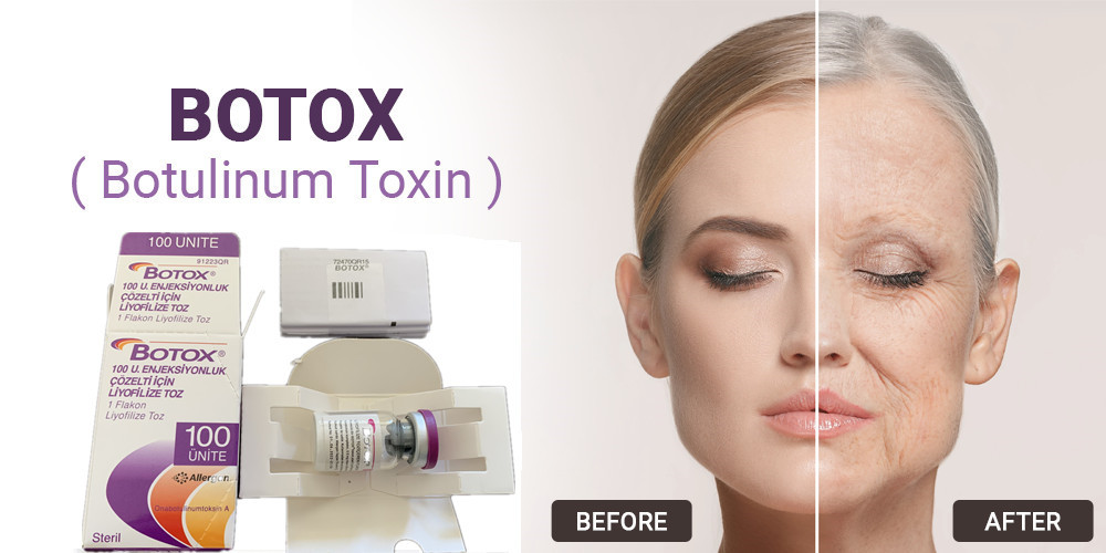 100Units Allergan Botulinum Toxin Type A Injection For Facial Wrinkle ...