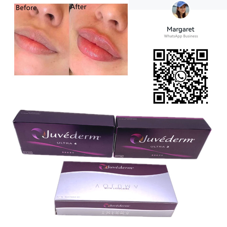 Juvederm Dermal Filler 2x1ml Syringe Needles Cross Linked Gel Lip Injection