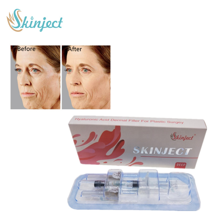 Injection Dermal Lip Filler For Deep Facial Wrinkles And Folds