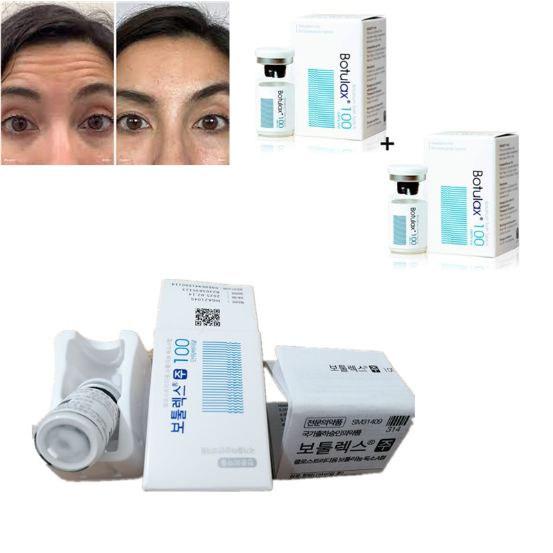 100 Units Korea Botulinum Toxin Injections Type A For Wrinkles Remove