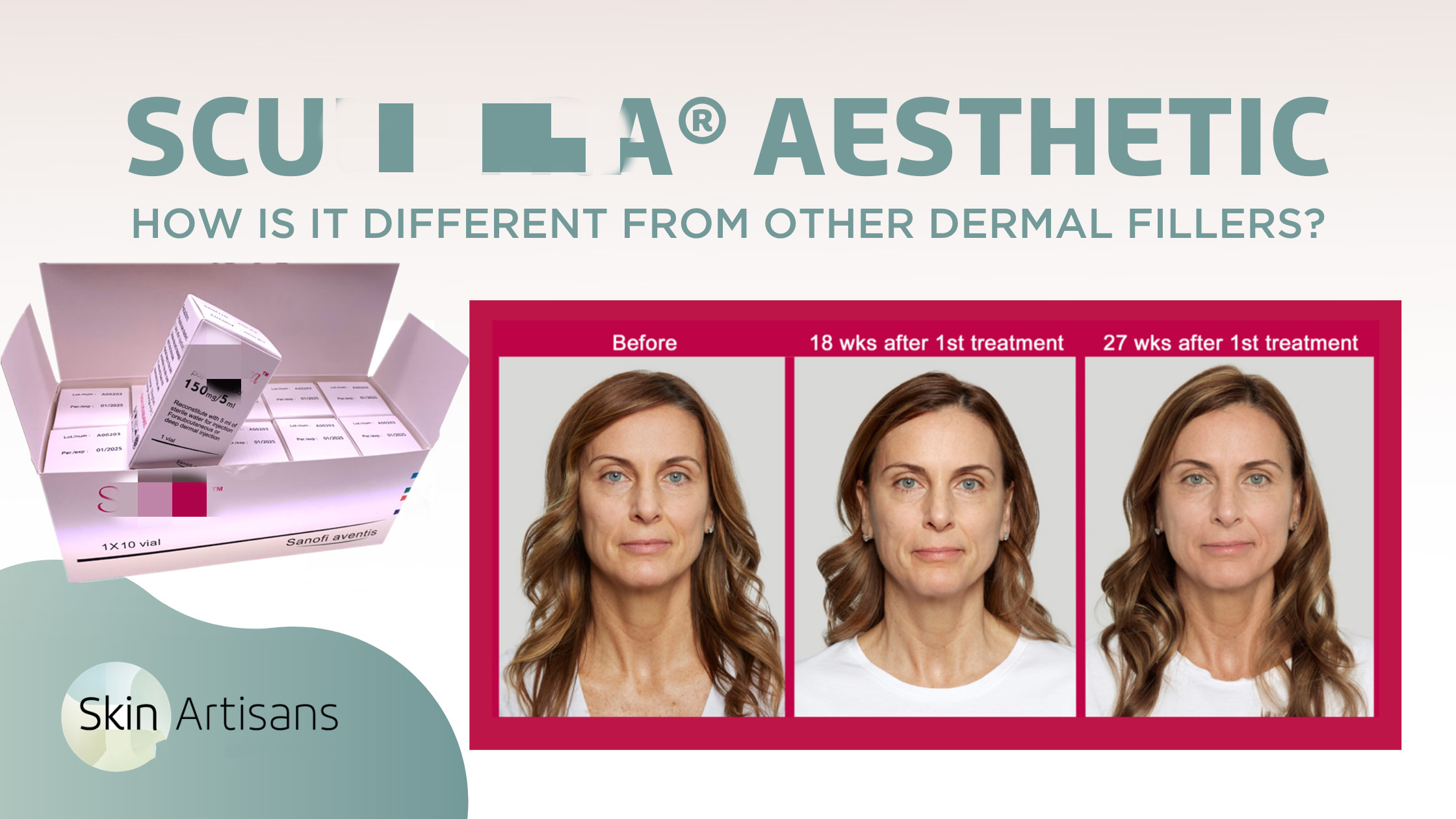 PLLA Facial Lifting Injection 150mg/ml