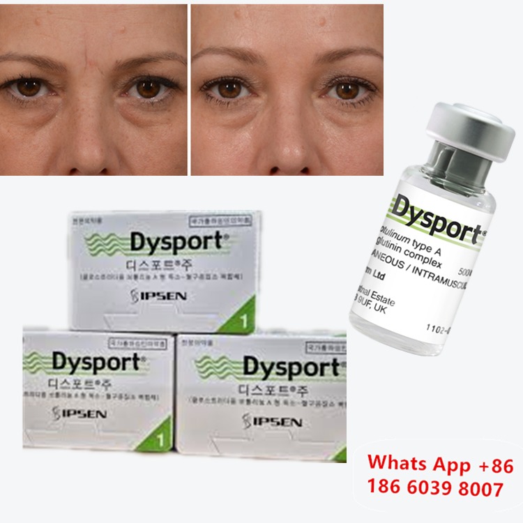 Botulinum Toxin Dysport Clostridium Botulinum Type A For Nose Correction