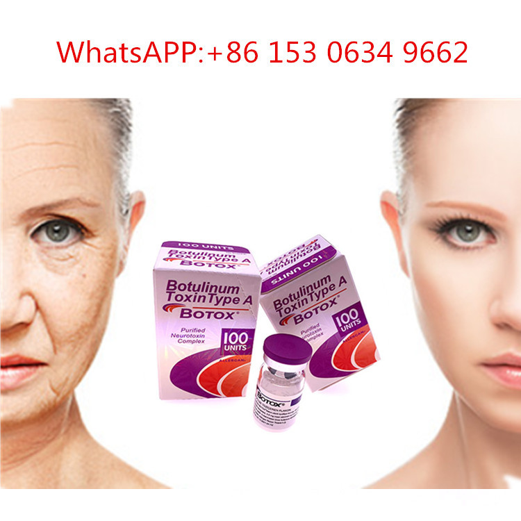 50u 100u 150u Type A Allergan Injection Botulinum Toxin For Anti Wrinkle