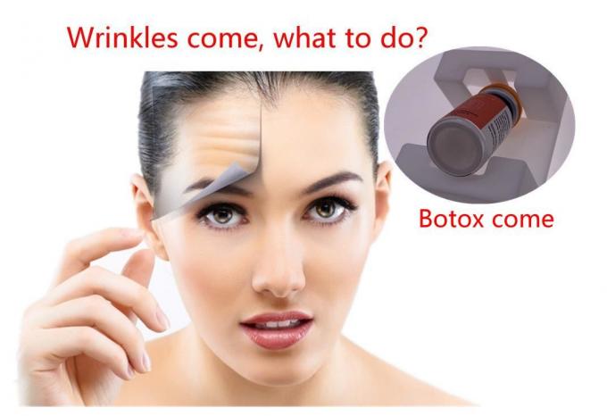 Wrinkle Removal Botulinum Toxin 100 Allergan Units For Face Lift Injection